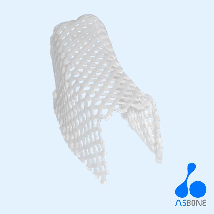 ASBONE – Absorbable Structures for Bone Regeneration